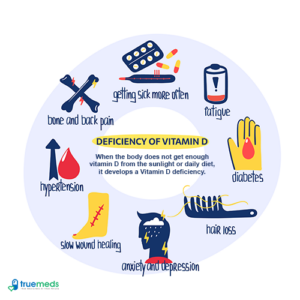 Vitamin D Deficiency Symptoms, Causes, and Supplements