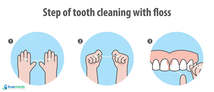 Oral hygiene: Best practices, Symptoms, and treatments